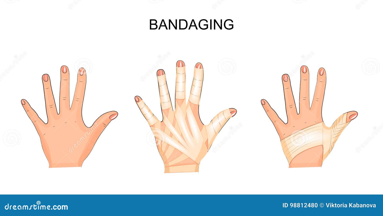 The bandages hands stock vector. Illustration of hurt - 98812480