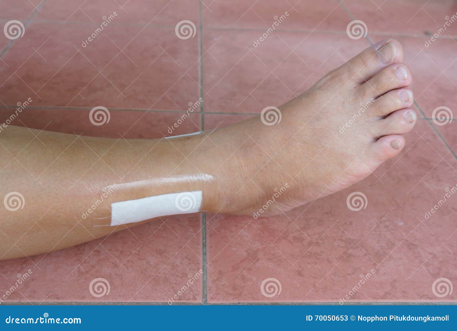 Bandages taped to the leg stock image. Image of protection - 70050653