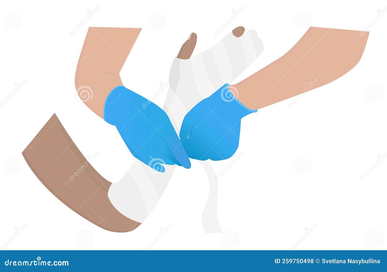 Bandaging a Broken Arm Vector Illustration Stock Vector - Illustration ...