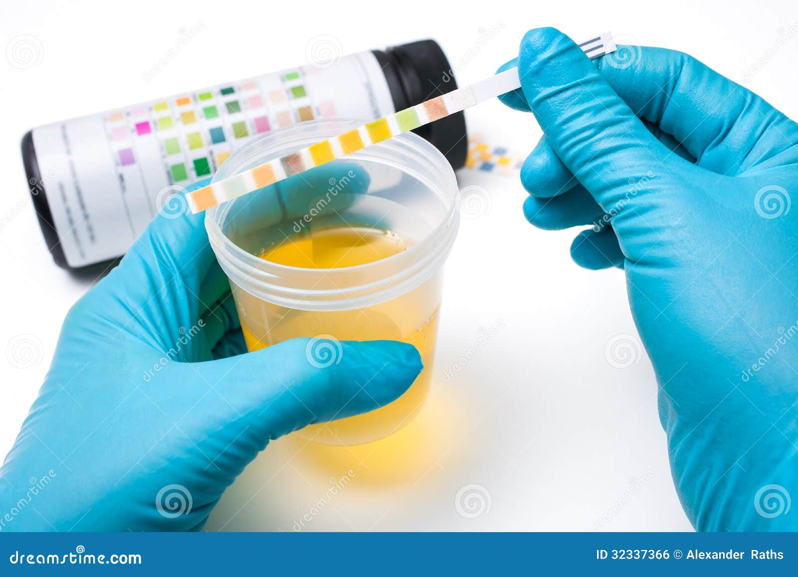 Bandes d'analyse d'urine photo stock. Image du chimique - 32337366