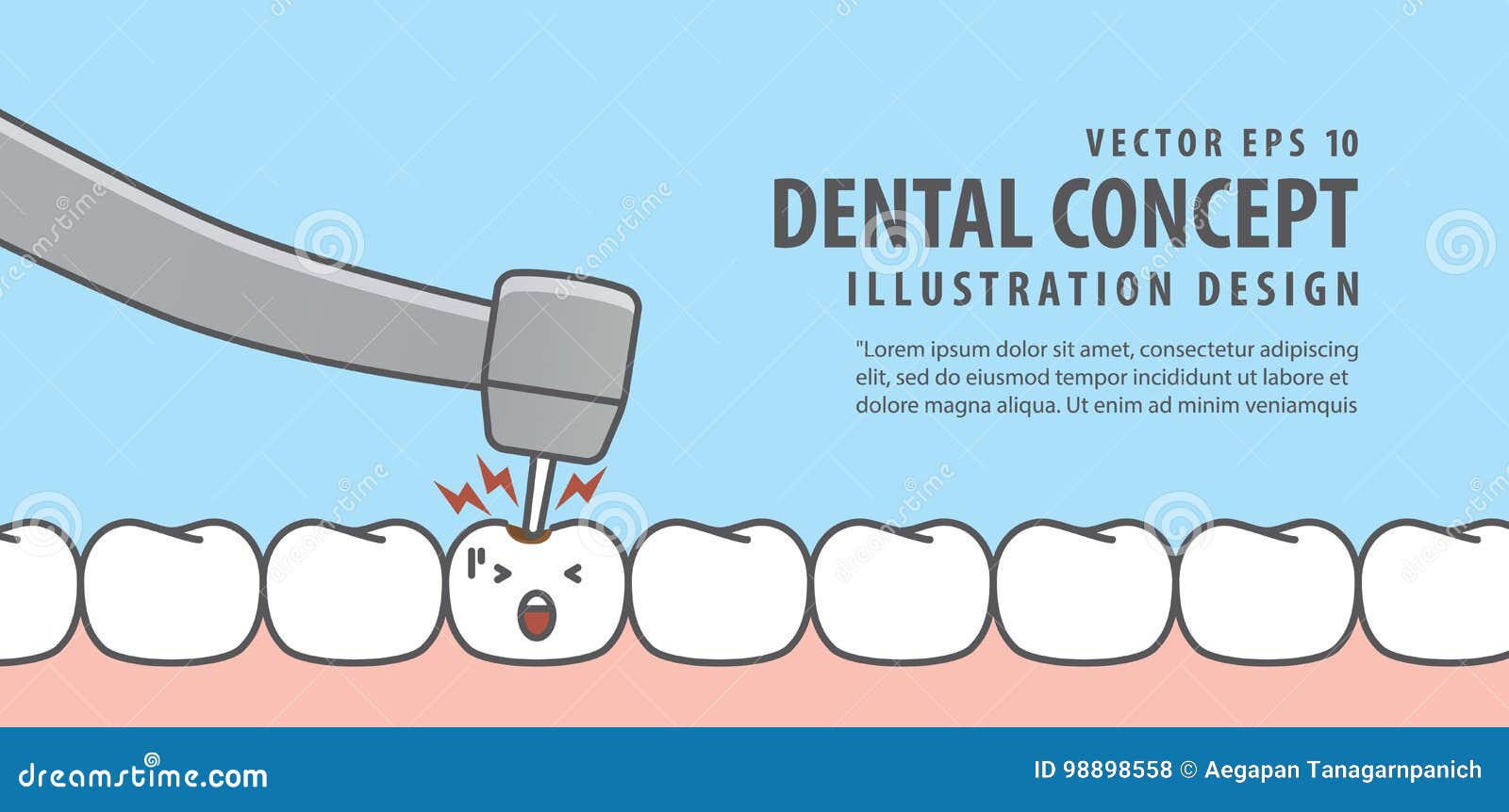 Banner Caries Tooth with Dental Bur Illustration Vector on Blue Stock ...