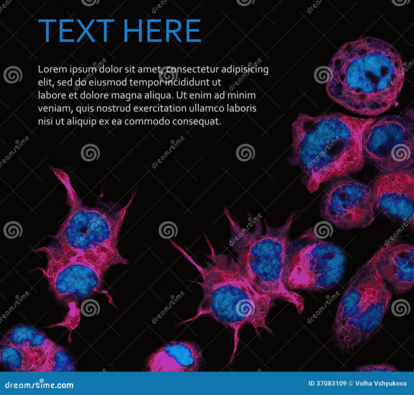 Fluorescence Microscope Image Of Human Cells Undergoing Mitosis Stock ...
