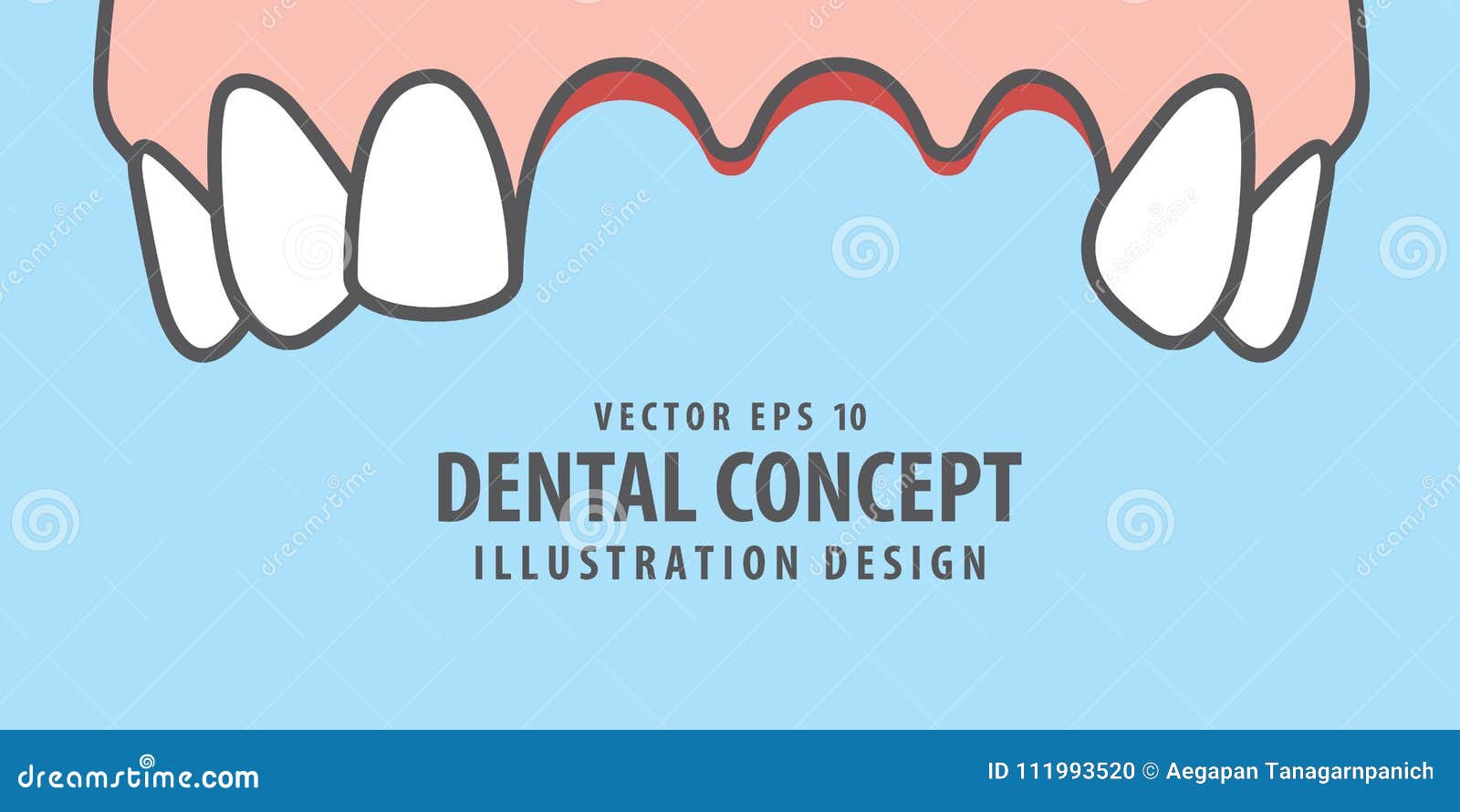 Banner Upper Lost Teeth Illustration Vector on Blue Background. Stock ...