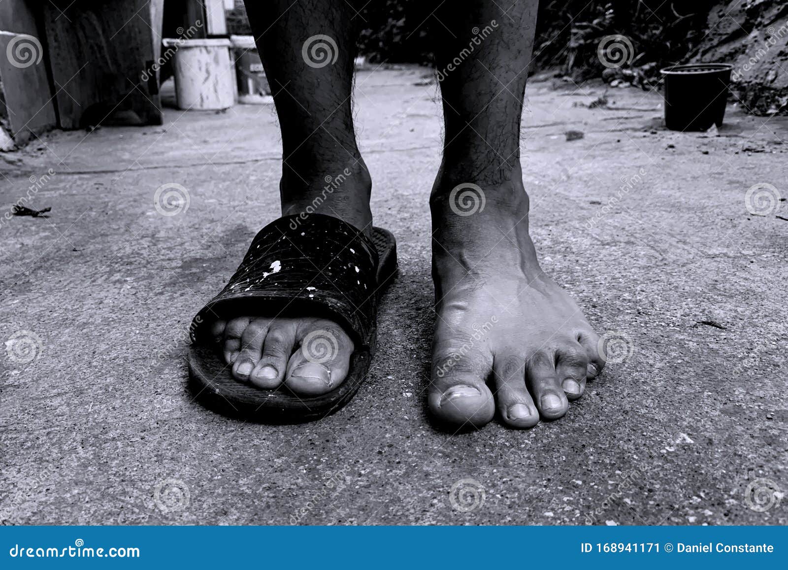 Bare Feet of Poor Person. Poor Homeless Person in Depression Stock ...