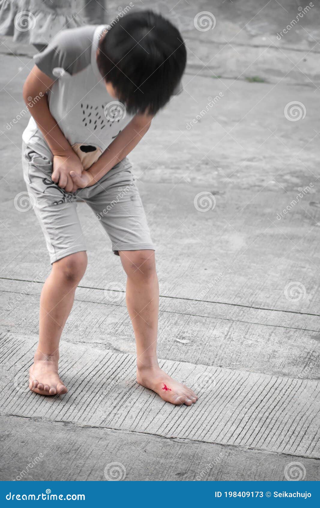 Bare Foot Bleeding after Injury on a Boy Stock Image - Image of agony ...