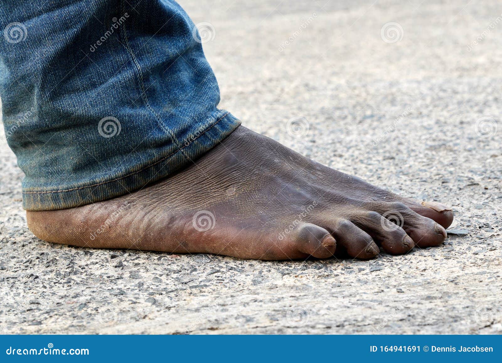 The Bare Foot of a Man from the Gambia Stock Image - Image of black ...
