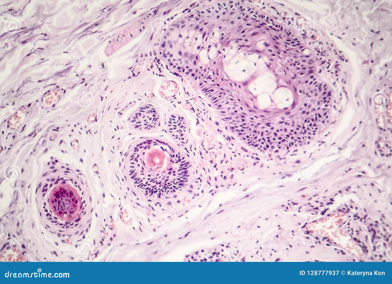 291 Basal Cell Microscope Stock Photos - Free & Royalty-Free Stock ...