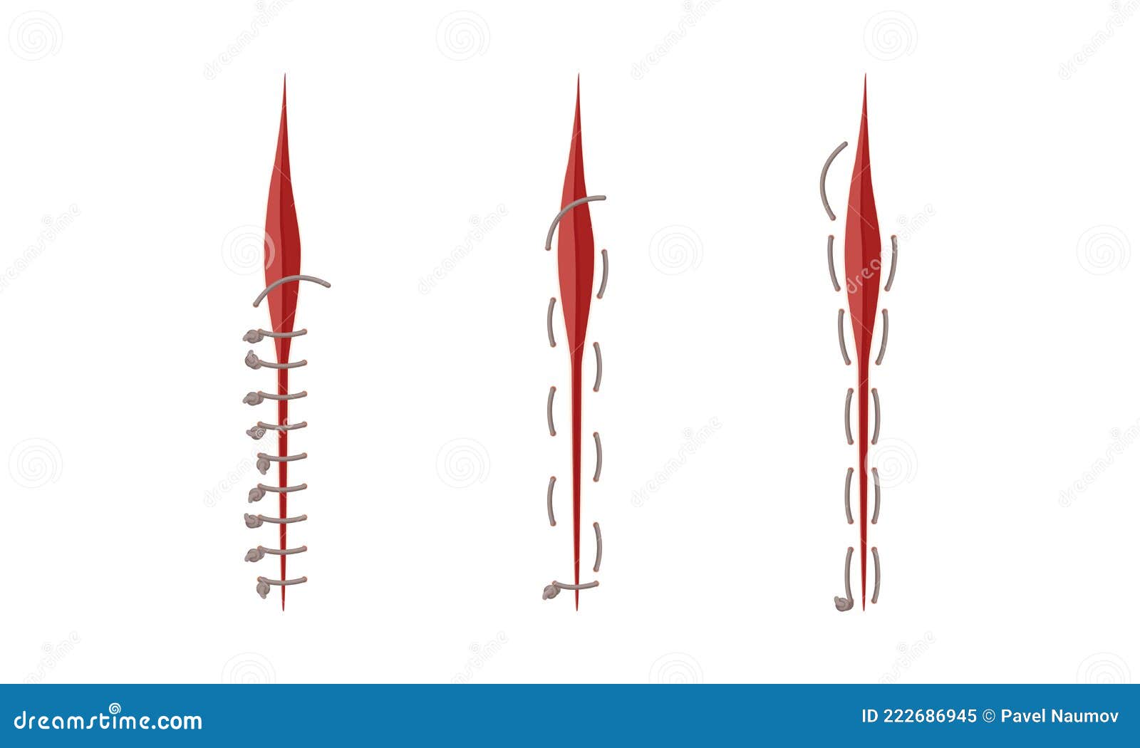 Baseball Stitches and Red Lace with Loop of Thread Isolated on White ...