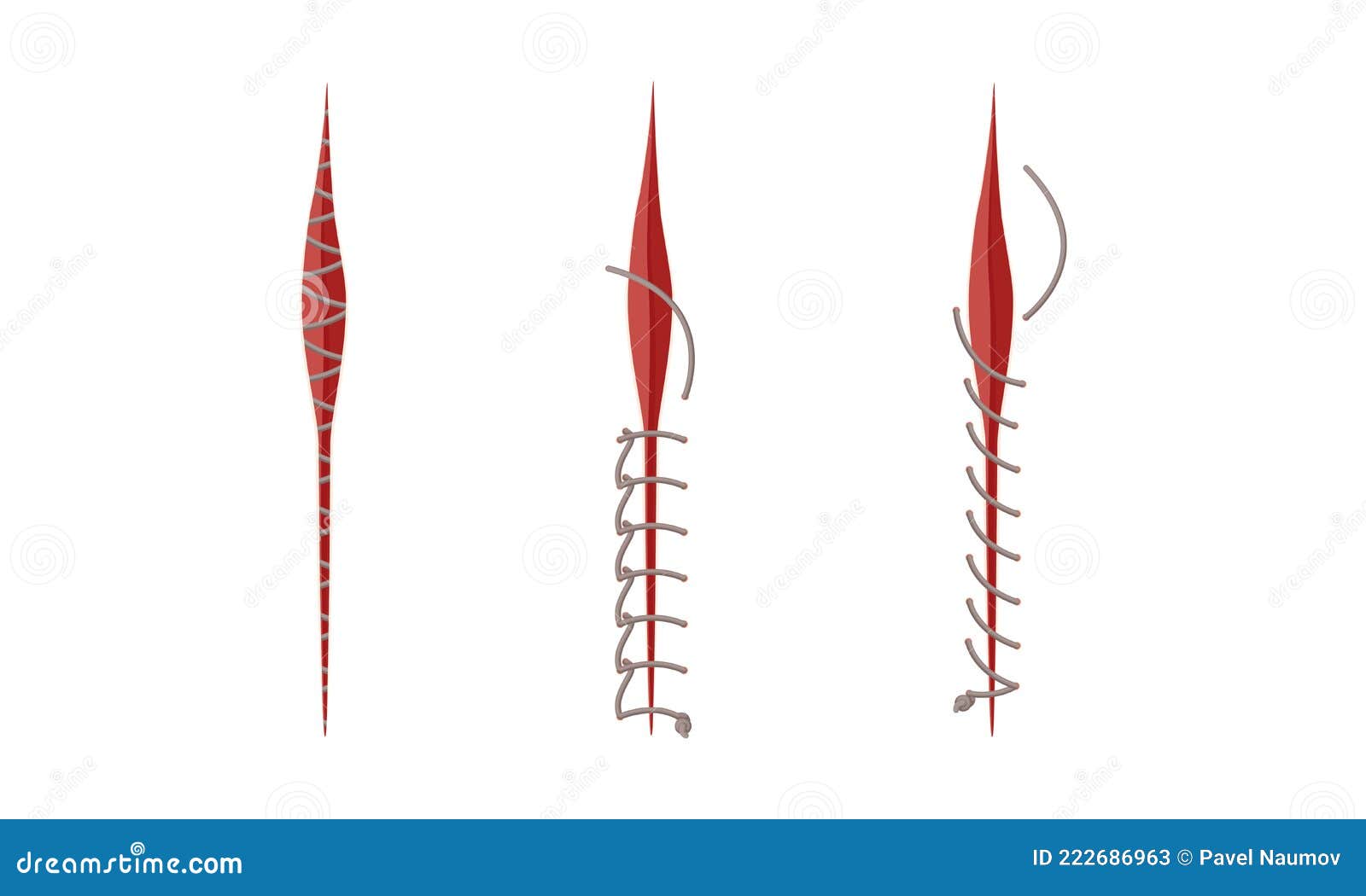 Baseball Stitches and Red Lace with Loop of Thread Isolated on White ...