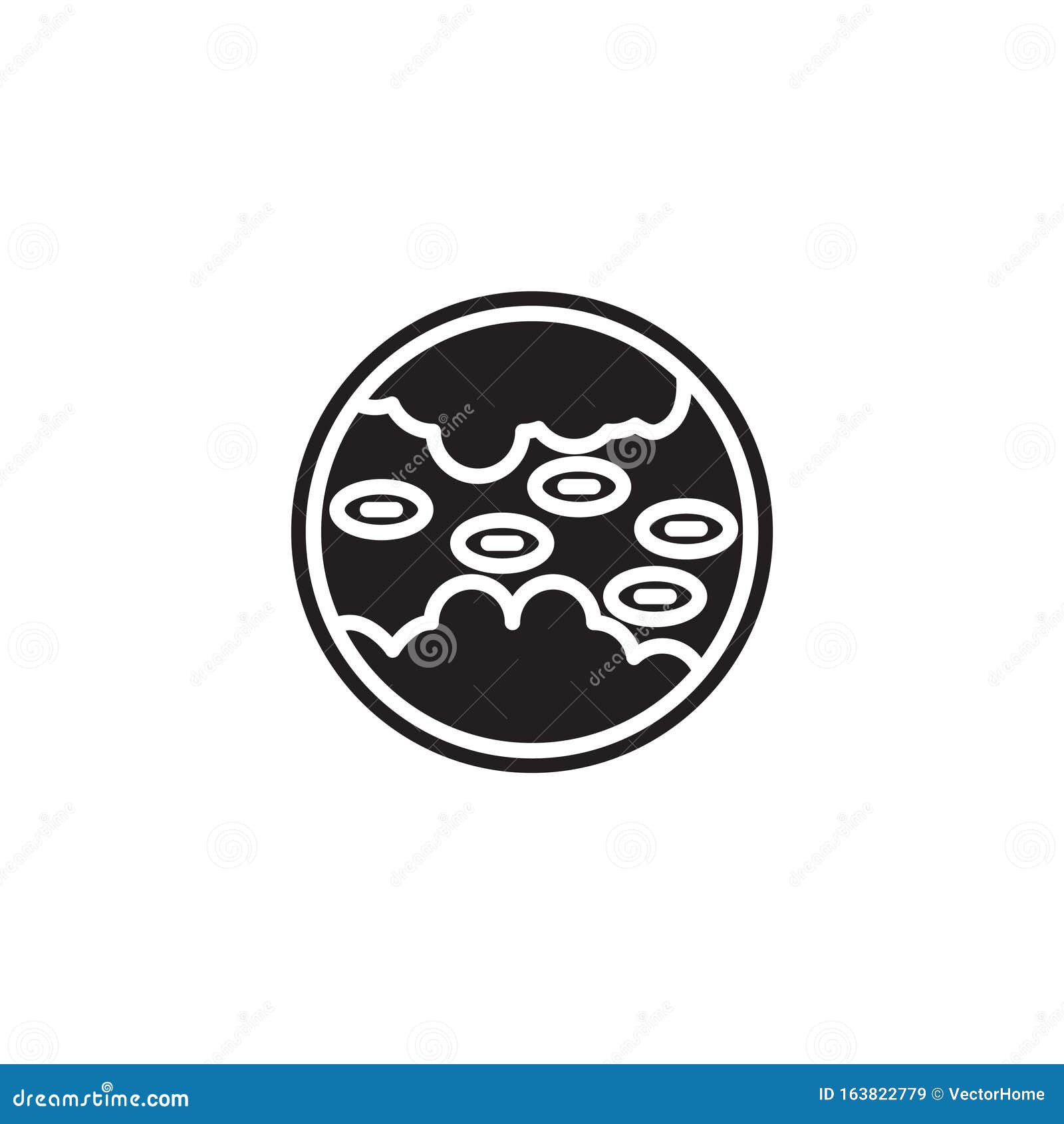 Artery Blocked With Cholesterol Illustration Blood Pressure Design, The ...