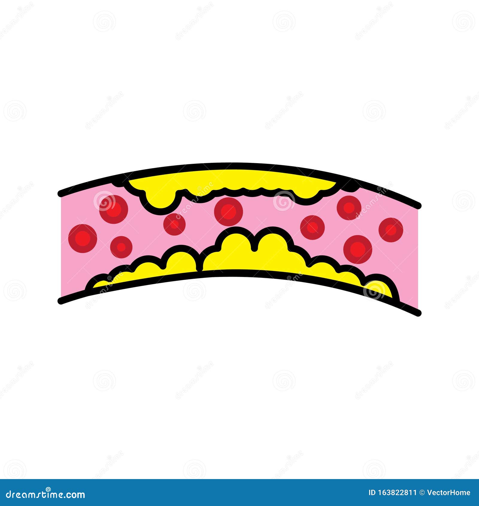 Cholesterol Icon, Artery Blocked with Cholesterol, Line Illustration ...