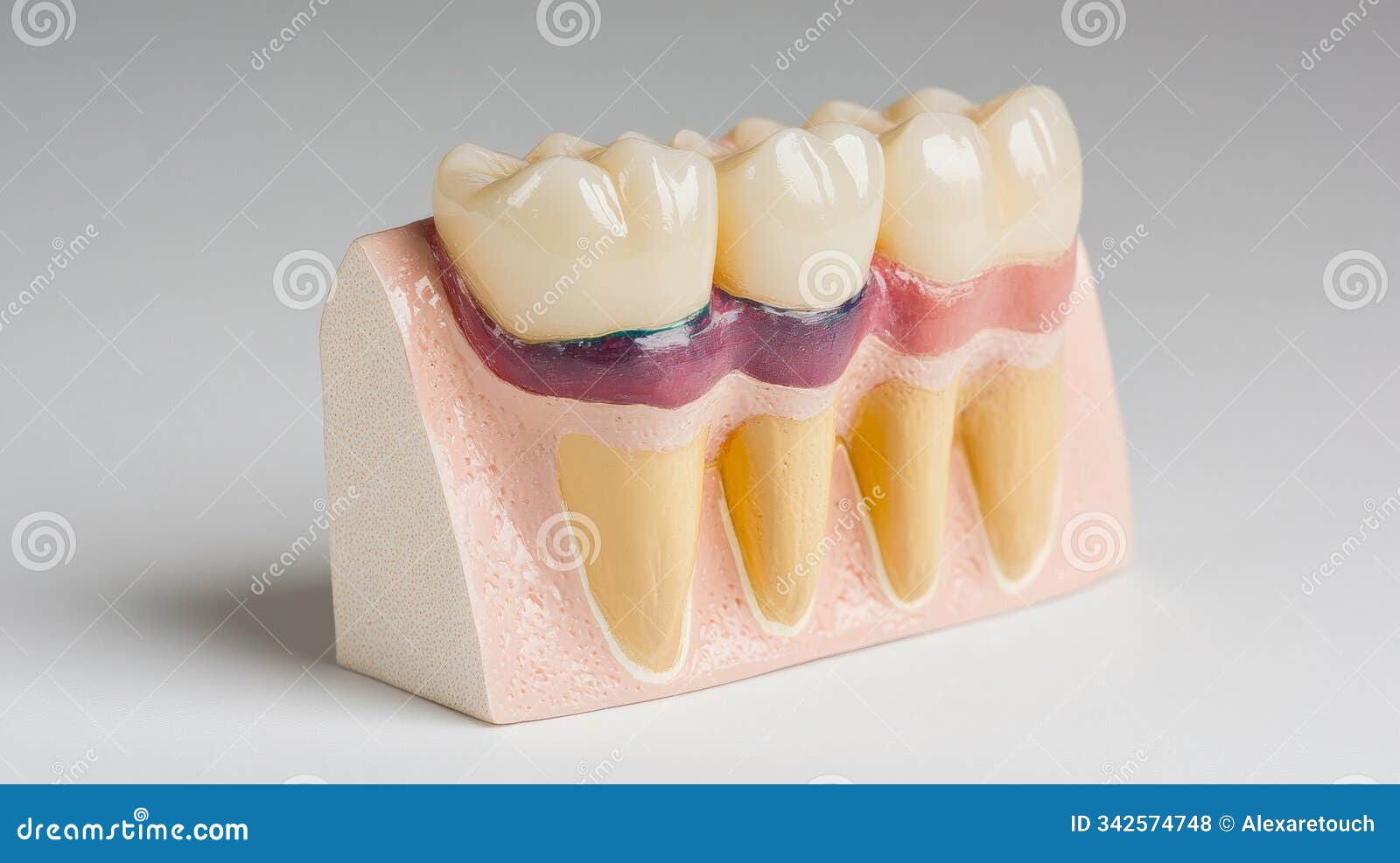 Basic Human Teeth Anatomical Model Stock Photo - Image of roots, tooth ...
