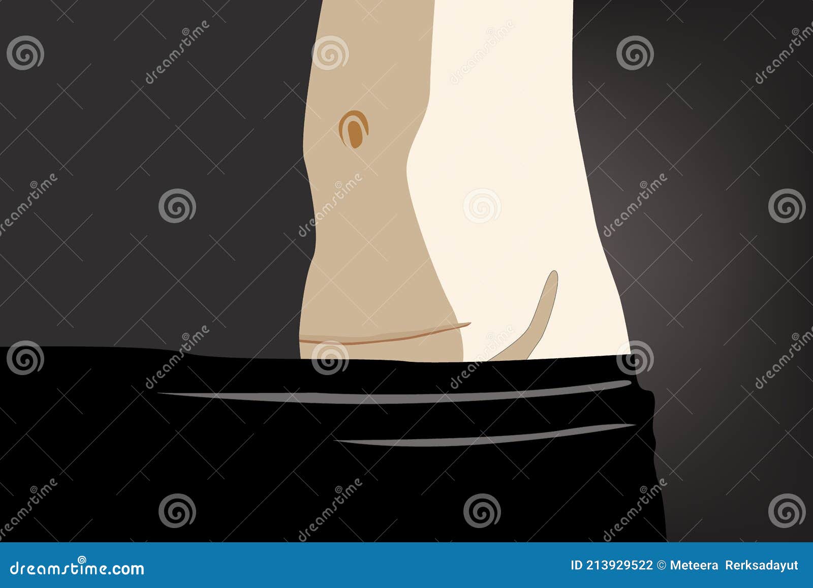 Surgical Incisions Of The Abdominal Cavity Vector Illustration ...