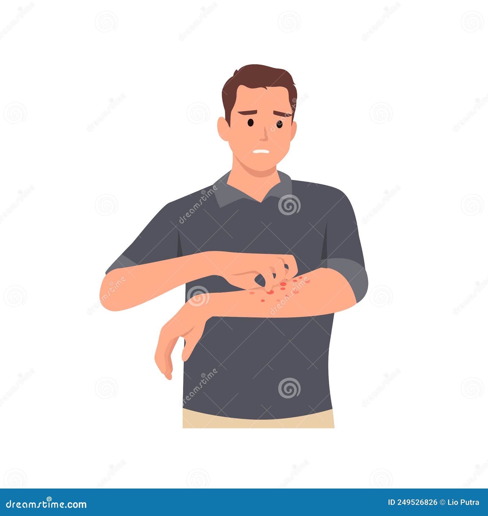 Young Man Scratching Arm. Guy Suffering from Strong Allergy Skin Stock ...