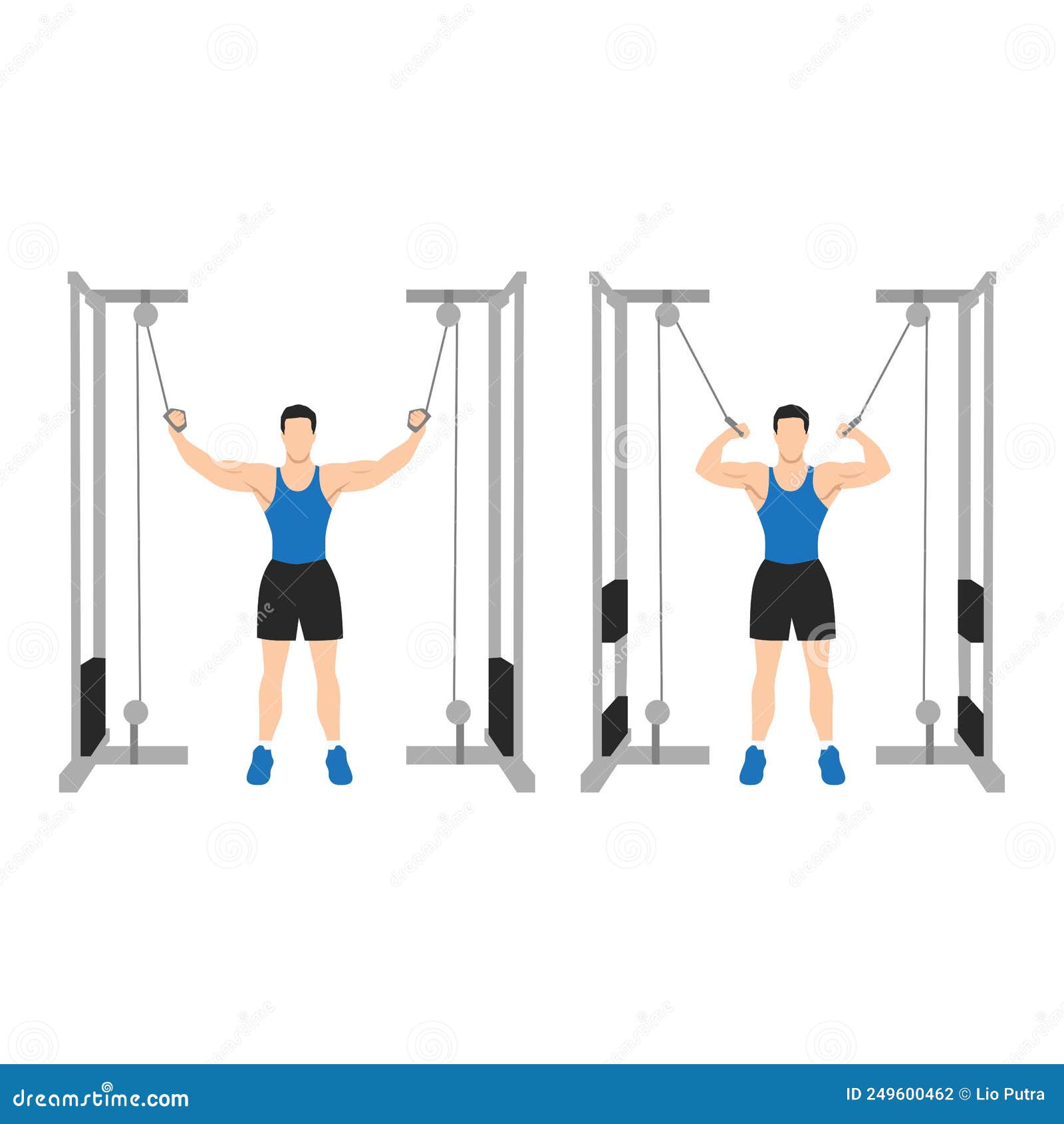 Overhead Cable Pulls