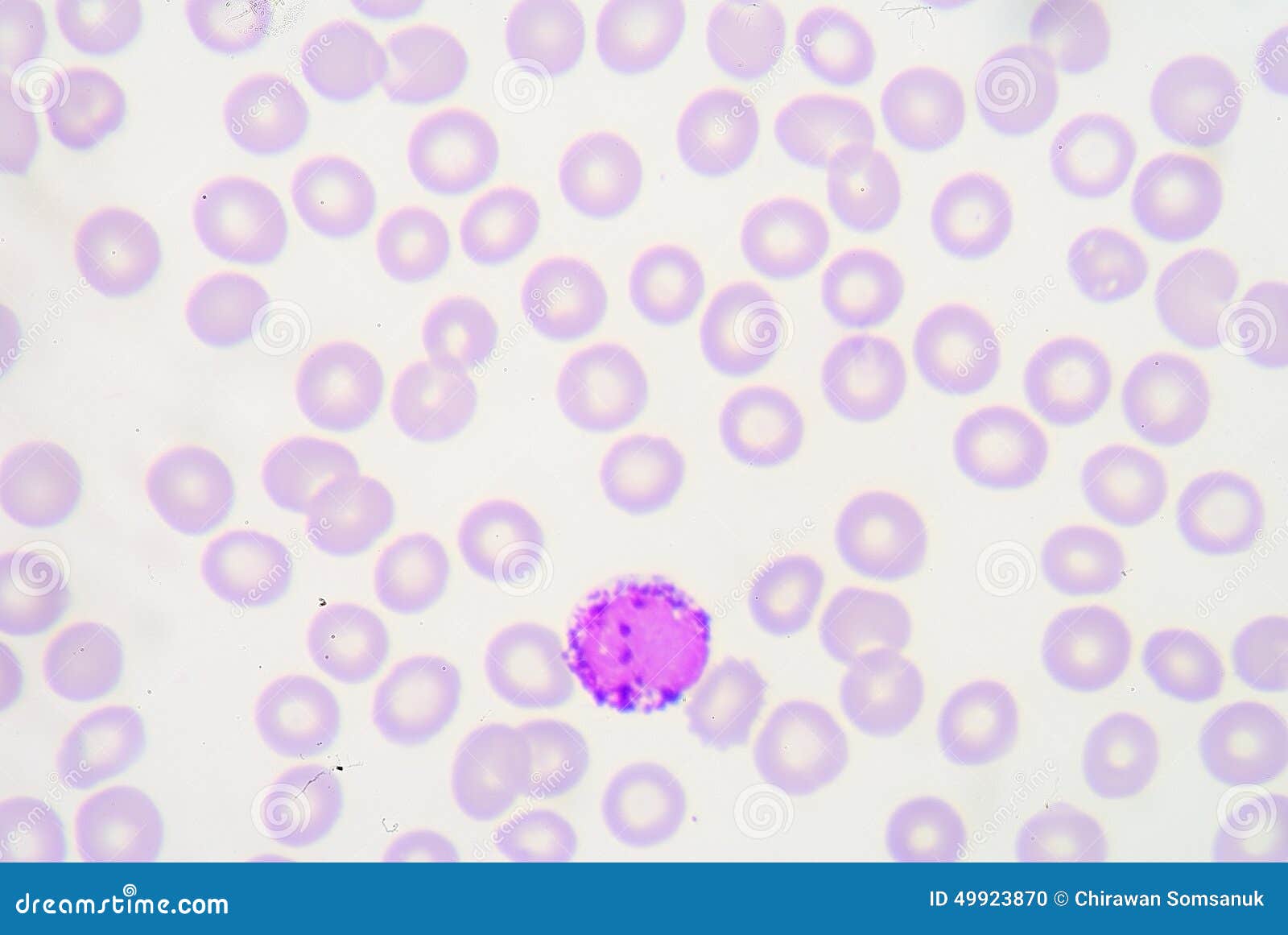 Basophil stock photo. Image of bactericidal, human, decrease - 49923870