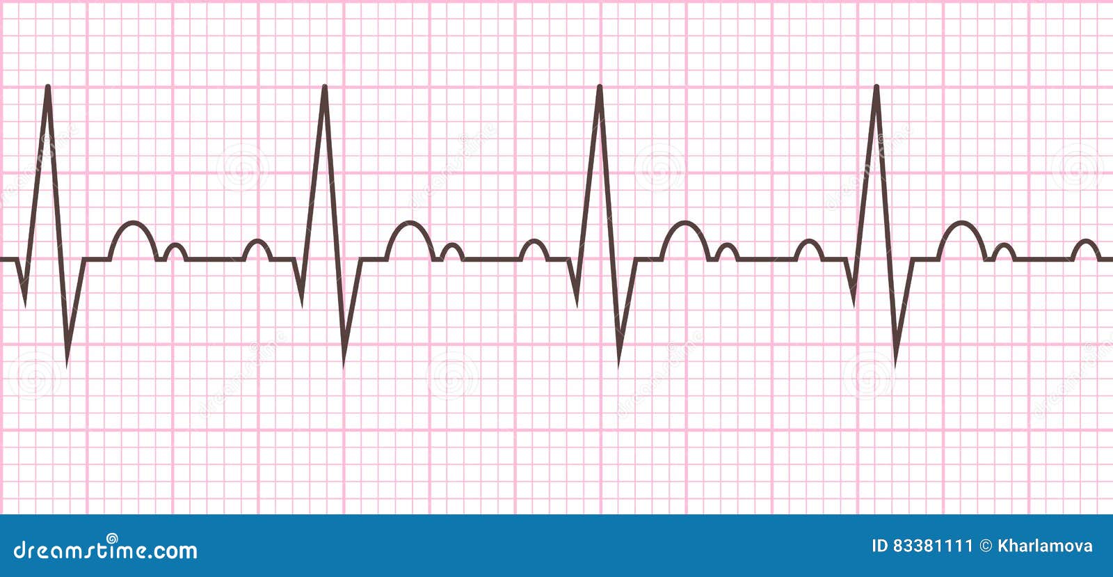Battement De Coeur Cardiogram Cycle Cardiaque Illustration de Vecteur ...