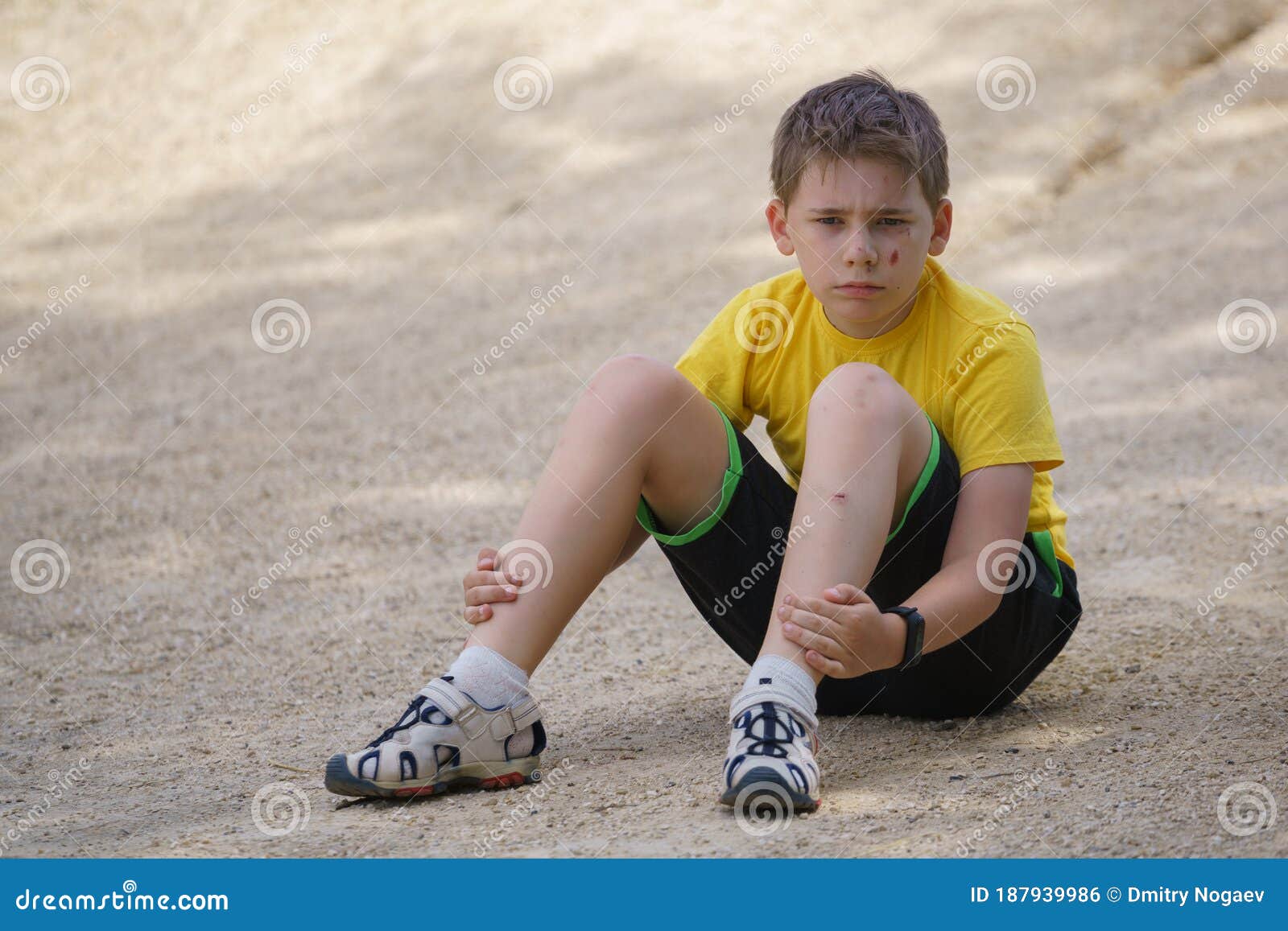 Battered Boy Sits on the Ground with a Scratched Face and a Sad Look ...