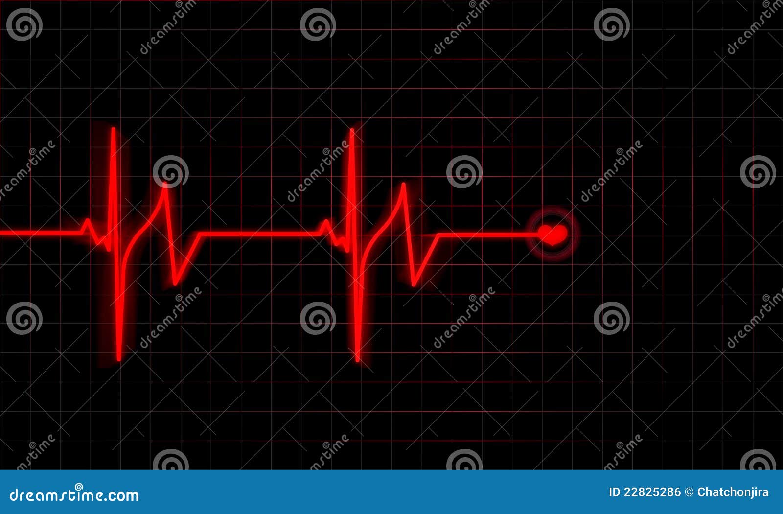 Battito cardiaco illustrazione vettoriale. Illustrazione di diagnostico ...