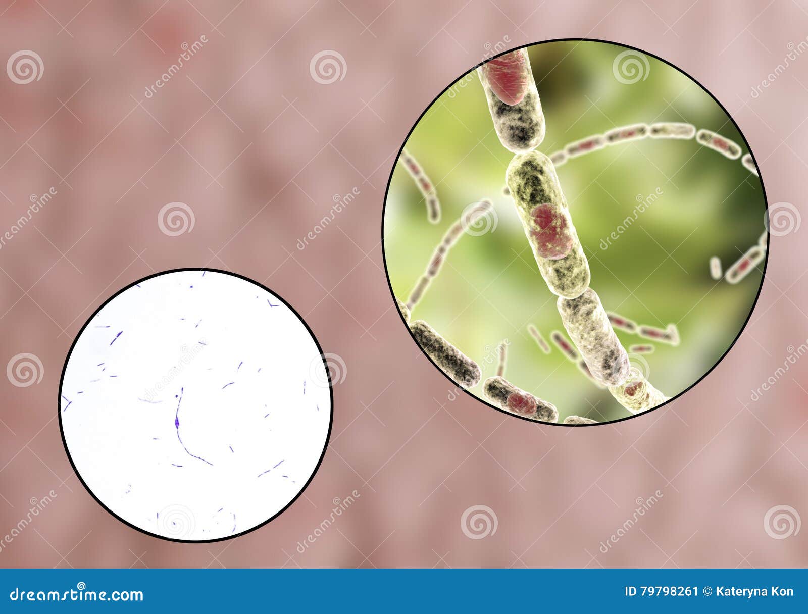 Bazillus Anthracis, Heller Mikrograph Und Illustration Stock Abbildung ...