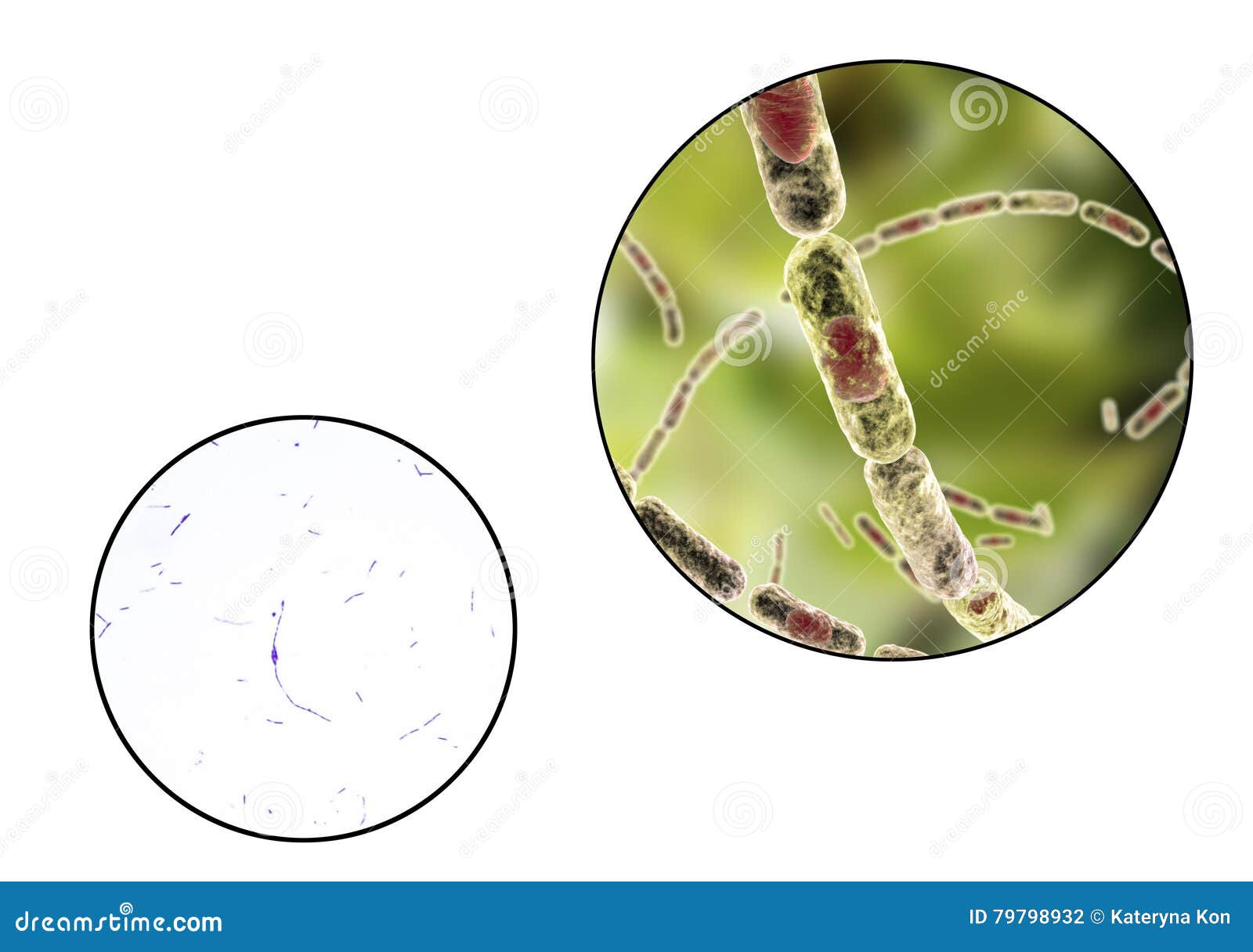 Bazillus Anthracis, Heller Mikrograph Und Illustration Stock Abbildung ...