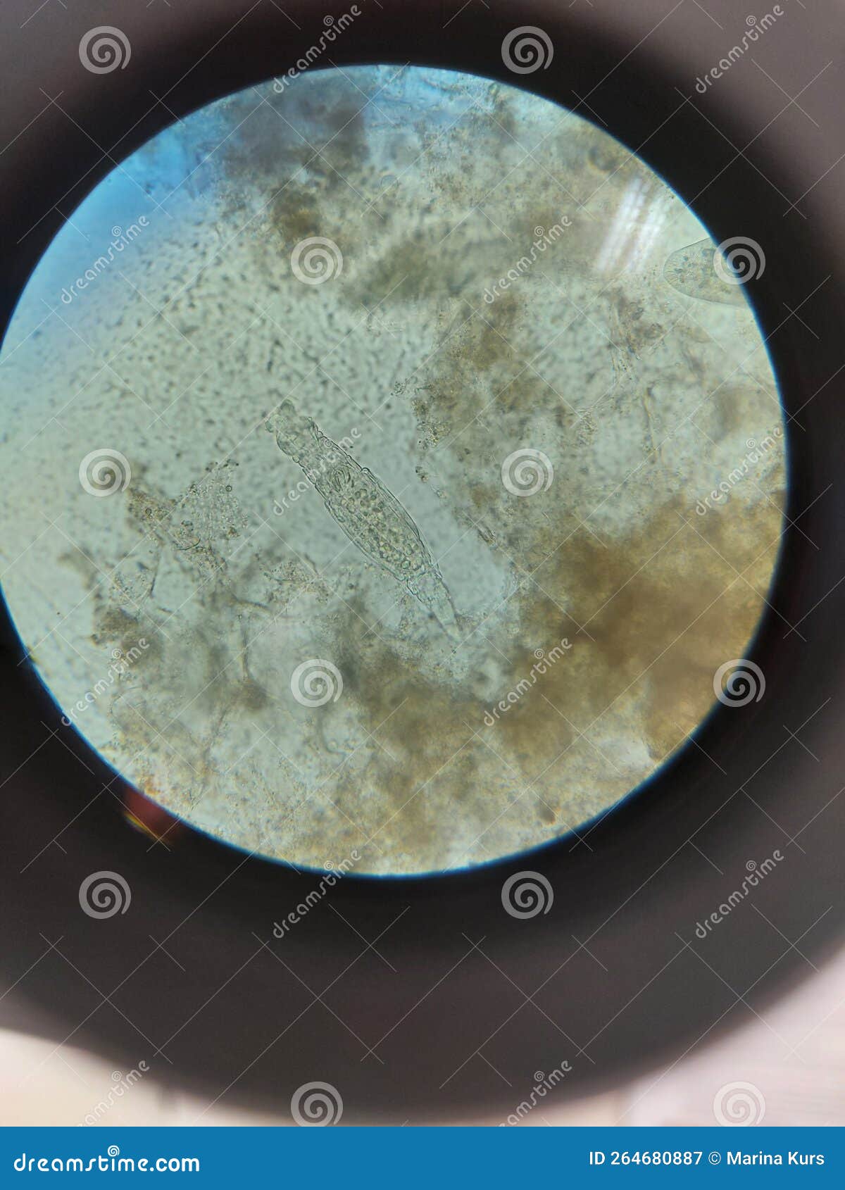 Bdelloida Zoology Microscope Stock Image - Image of blue, circle: 264680887