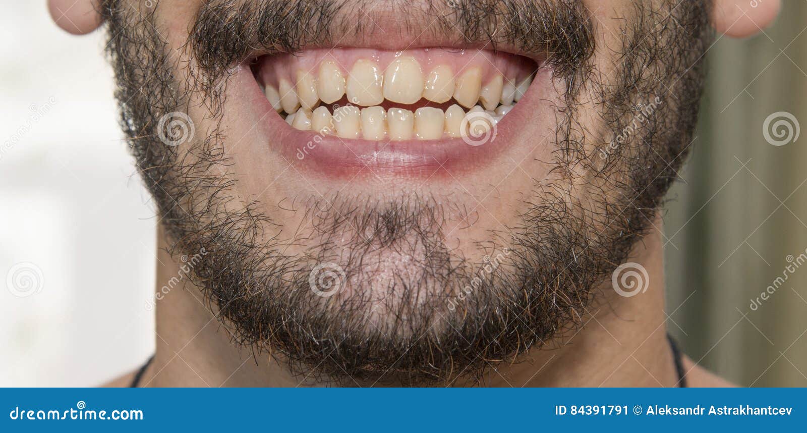 The Bearded Man Smiles, Showing Bad Teeth. Stock Image - Image of hair ...