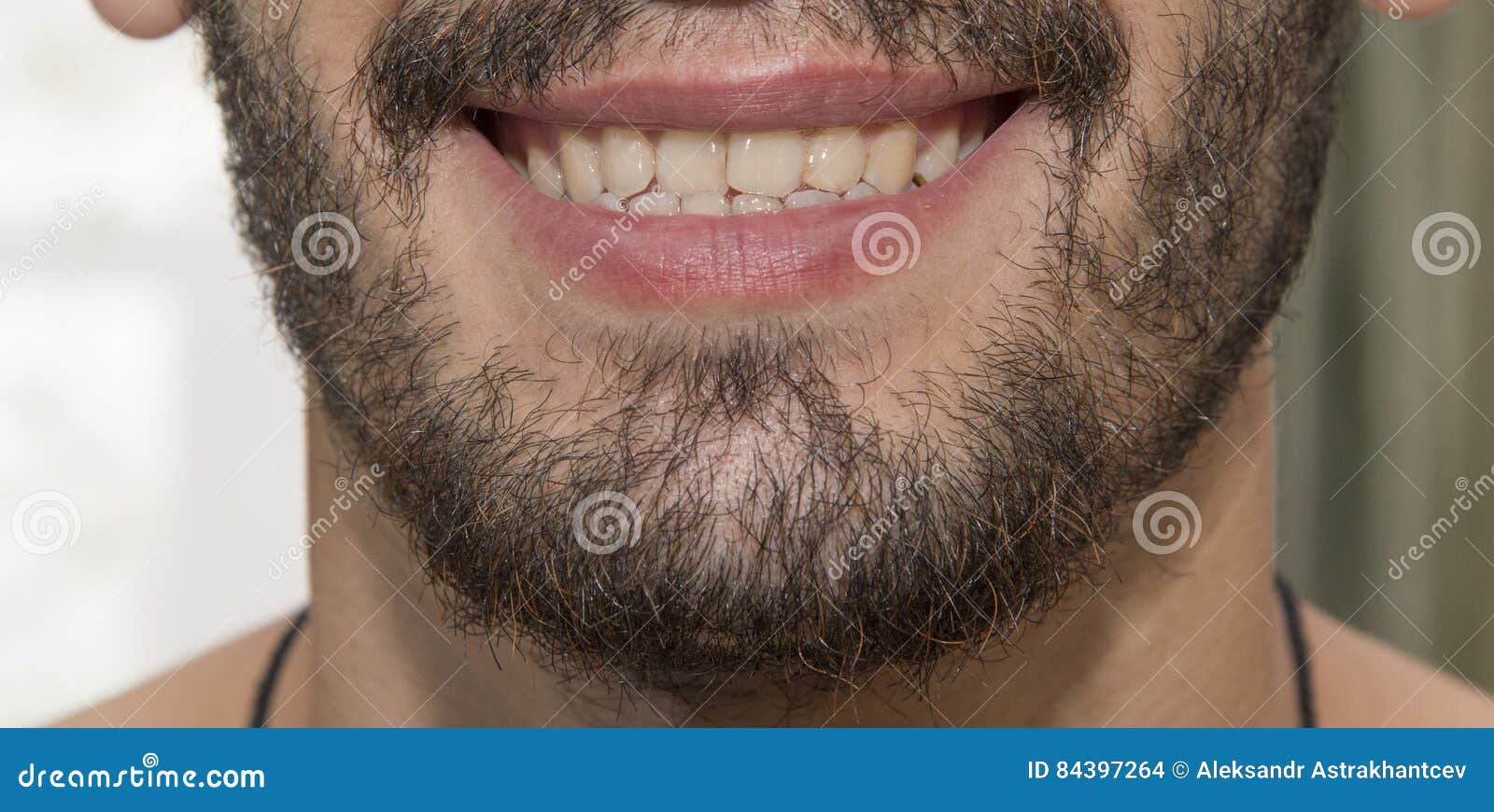 The Bearded Man Smiles, Showing Bad Teeth. Stock Photo - Image of body ...