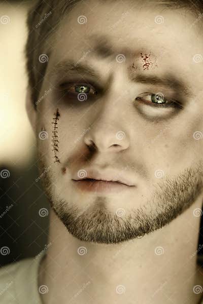 Beaten up boy stock image. Image of laceration, face, hospital - 6682881