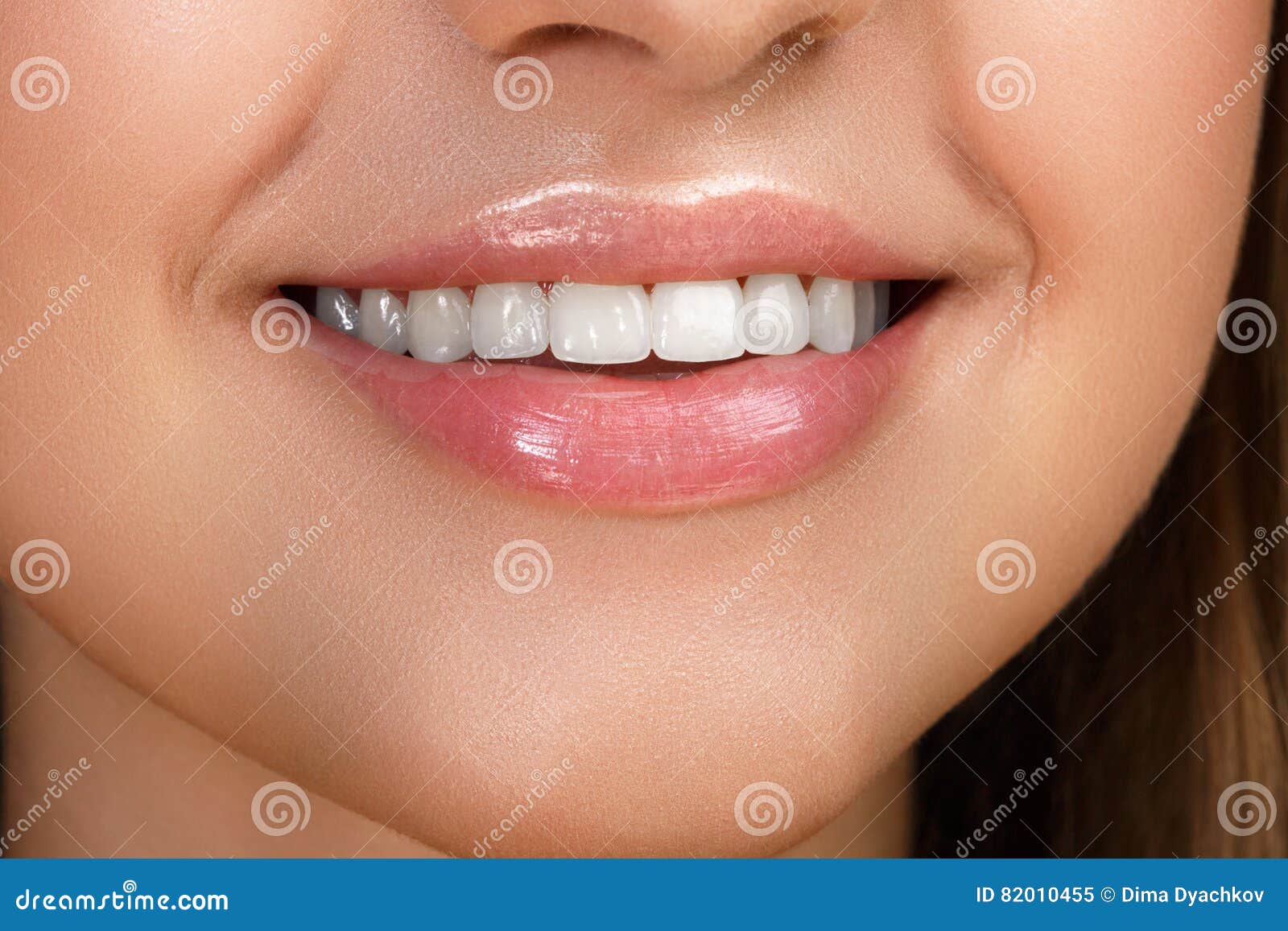 Beau Sourire Avec Blanchir Des Dents Image stock - Image du normal ...