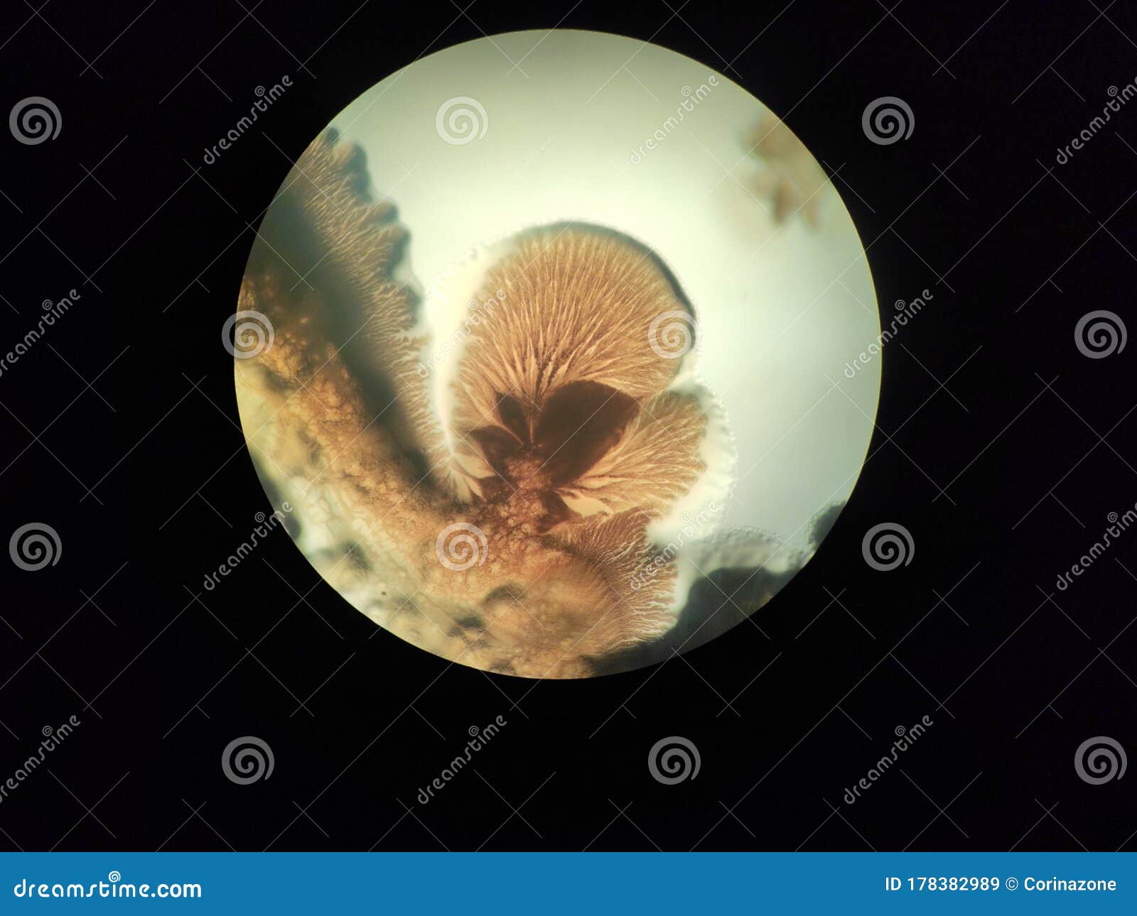 The Beautiful Art of Bacteria - Microscope View of Bacillus and Other ...