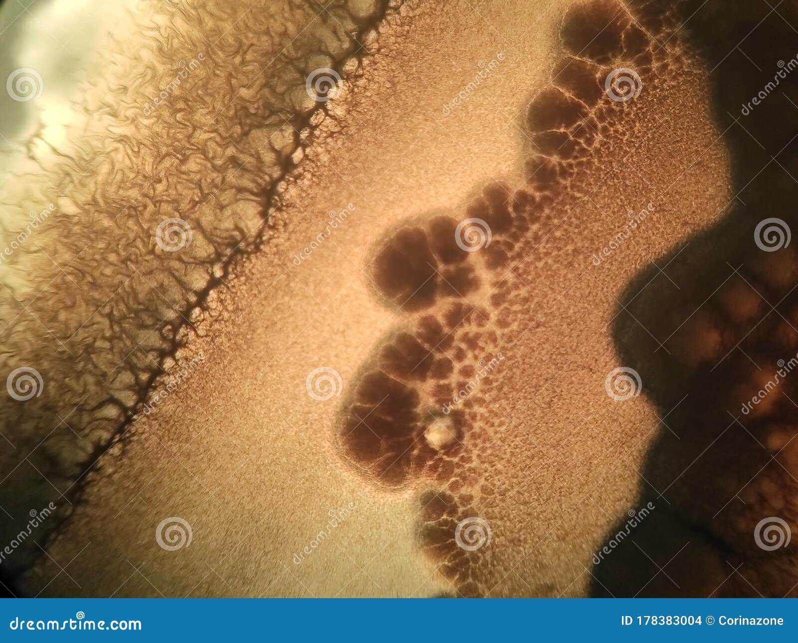 The Beautiful Art of Bacteria - Microscope View of Bacillus and Other ...