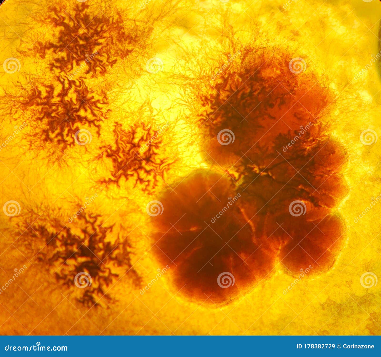 The Beautiful Art of Bacteria - Microscope View of Bacillus and Other ...