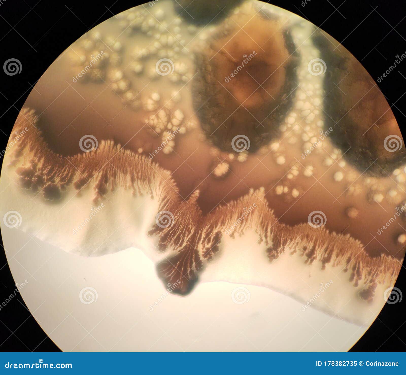 The Beautiful Art of Bacteria - Microscope View of Bacillus and Other ...
