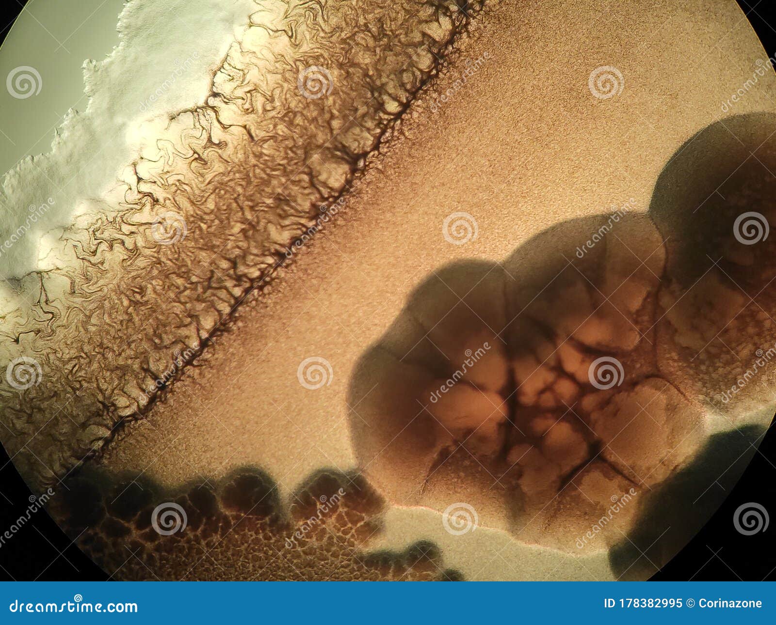 The Beautiful Art of Bacteria - Microscope View of Bacillus and Other ...