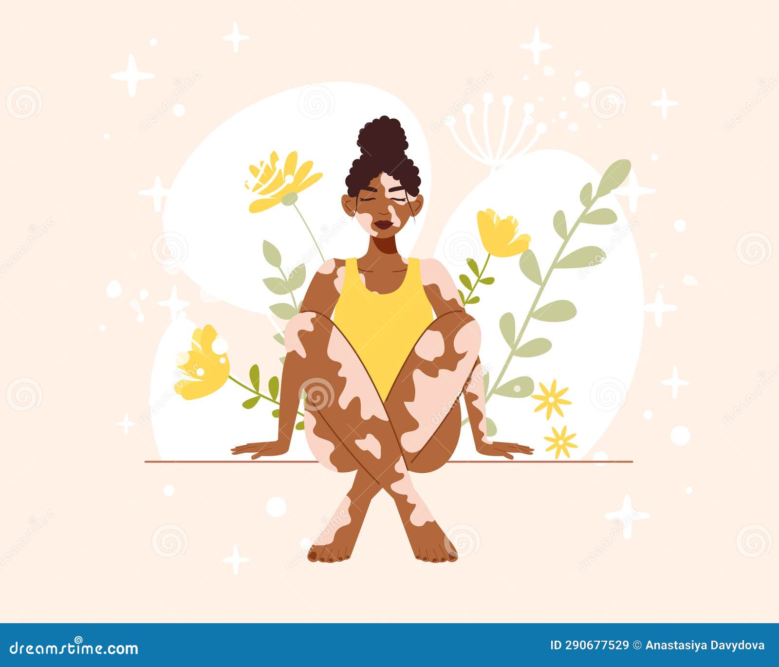 Character With Vitiligo Vector Icon, Pigmentation Skin On Different ... Character With Vitiligo Vector Icon, Pigmentation Skin On Different ...