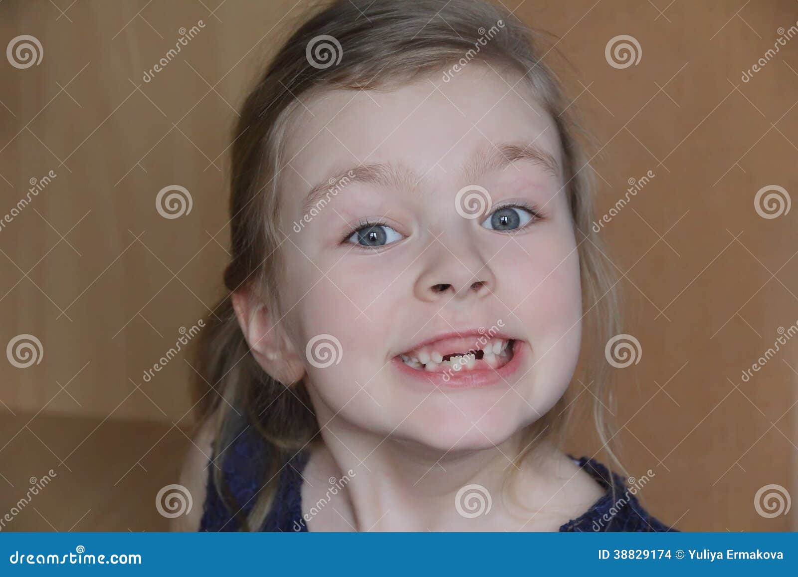 Beautiful Child without Front Teeth Stock Photo - Image of child ...