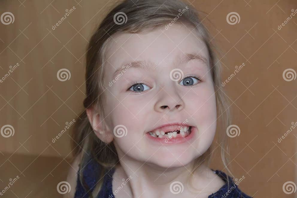 Beautiful Child without Front Teeth Stock Photo - Image of child ...