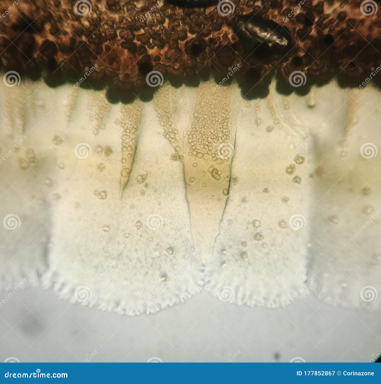 Beautiful Fractal Pattern Growth of a Bacterial Colony Under the ...