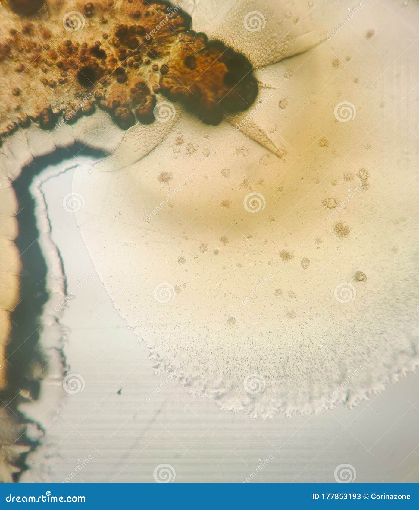 Beautiful Fractal Pattern Growth of a Bacterial Colony Under the ...