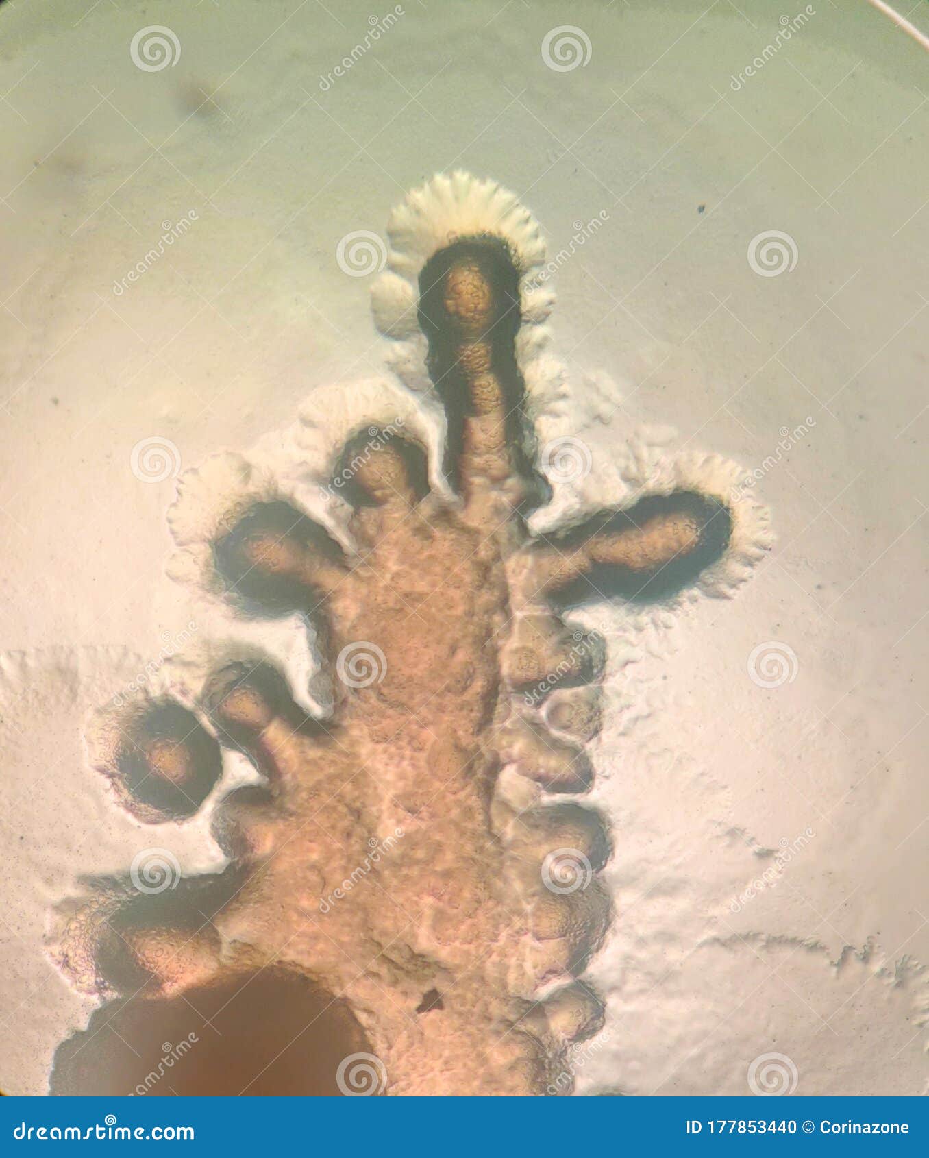 Beautiful Fractal Pattern Growth of a Bacterial Colony Under the ...