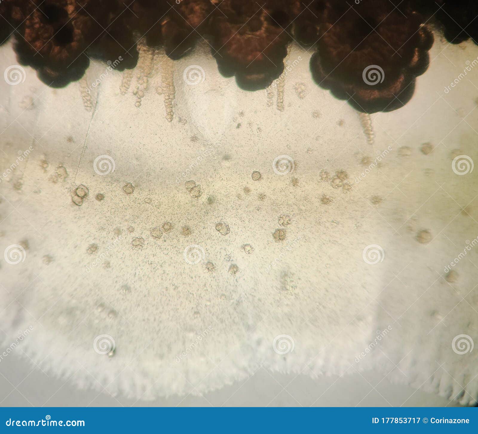 Beautiful Fractal Pattern Growth of a Bacterial Colony Under the ...