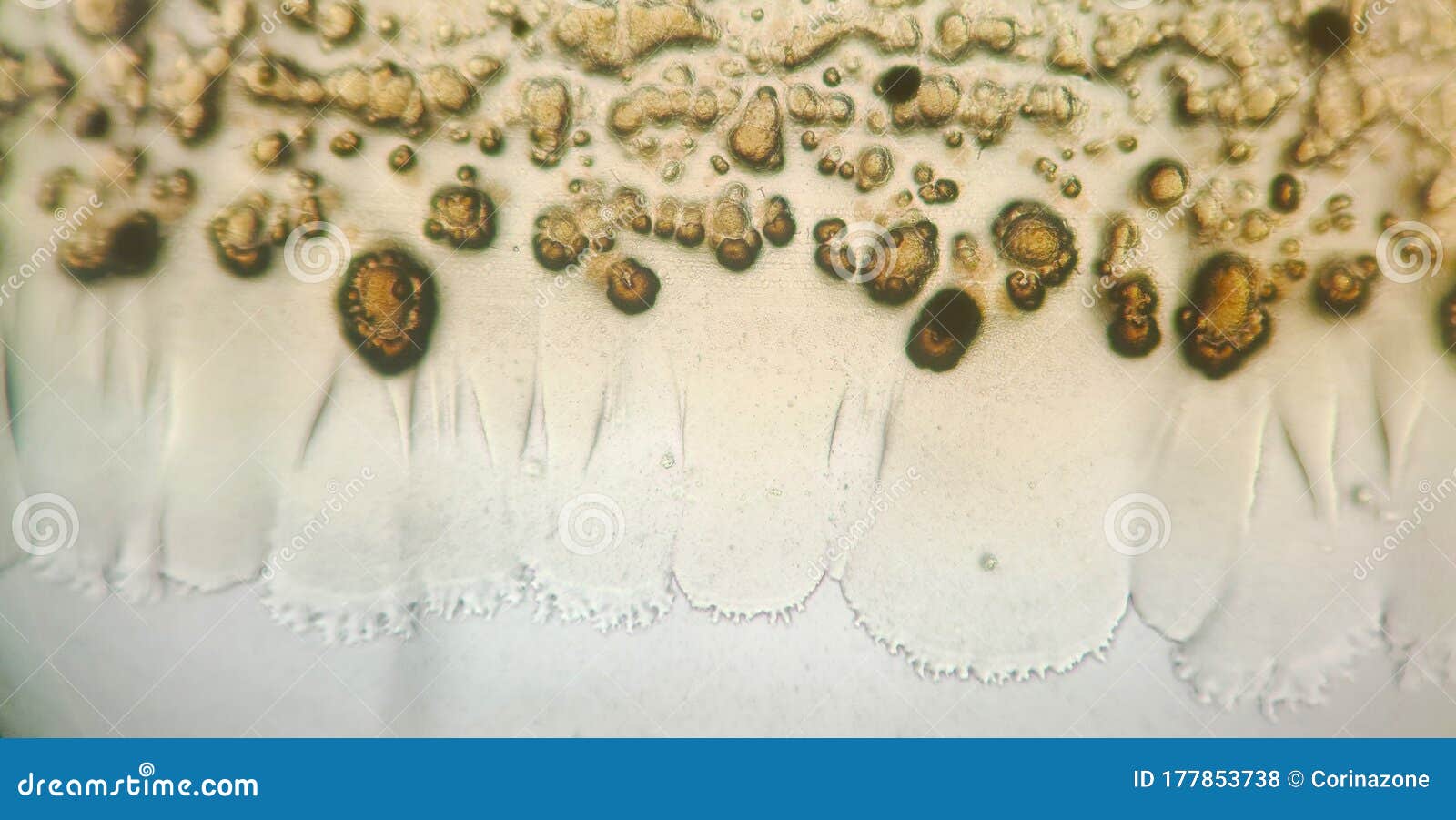 Beautiful Fractal Pattern Growth of a Bacterial Colony Under the ...