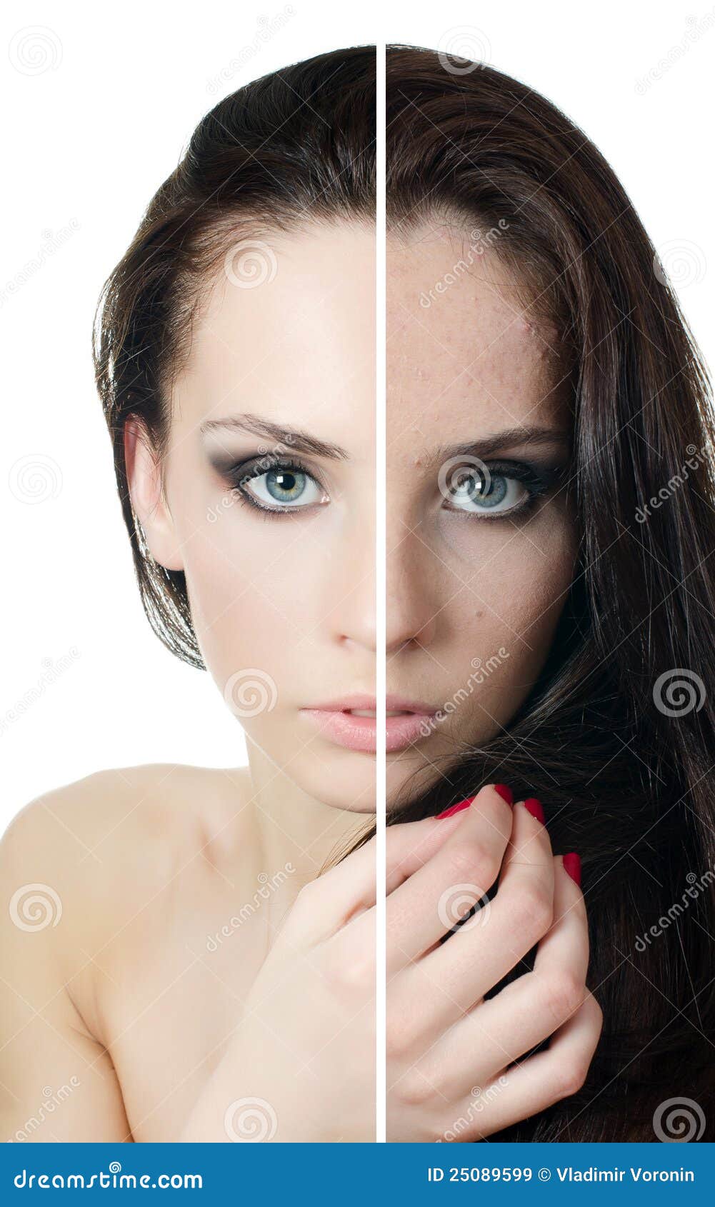 The Beautiful Girl with Problems on the Face Stock Image - Image of ...