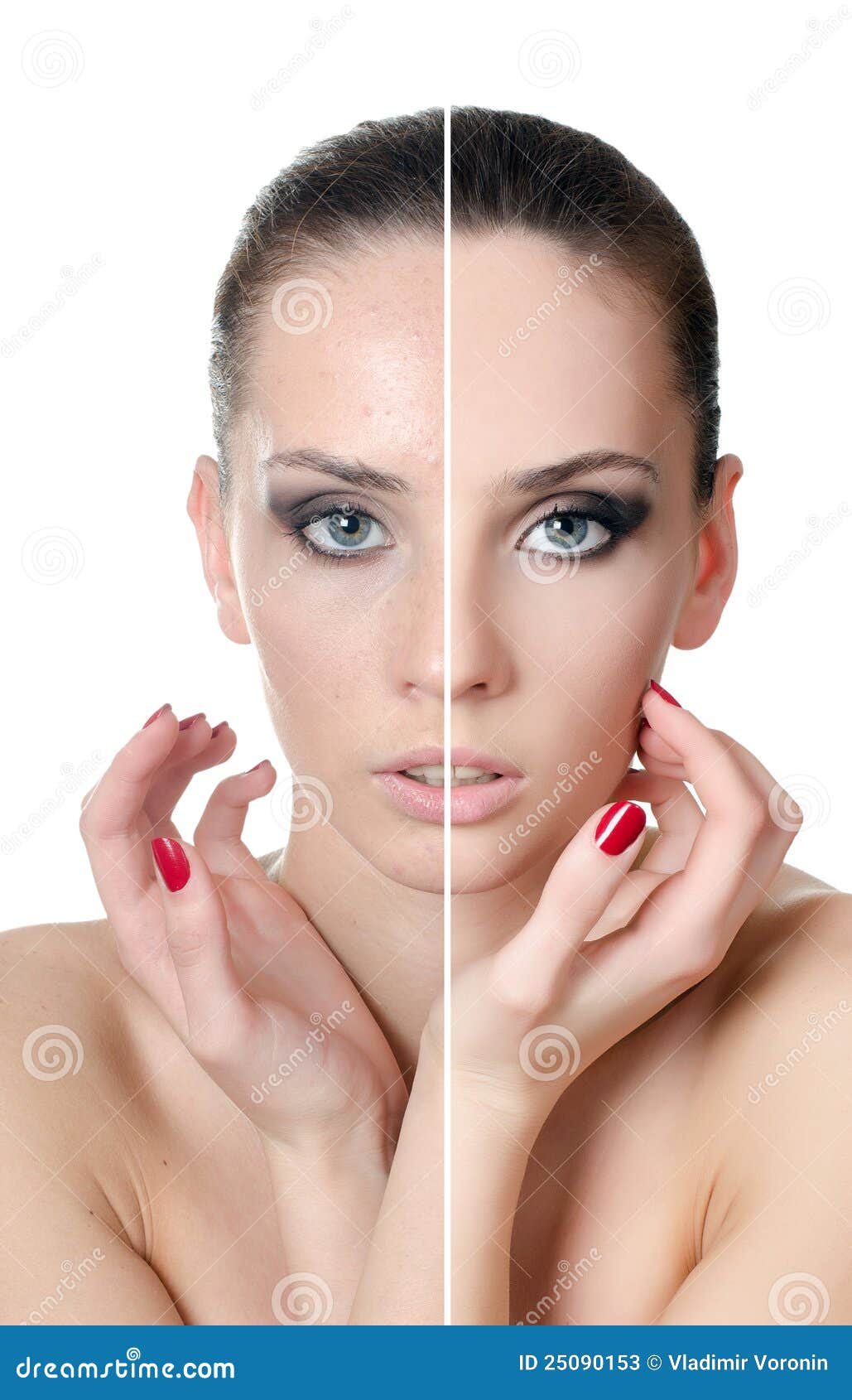 The Beautiful Girl with Problems on the Face Stock Image - Image of ...
