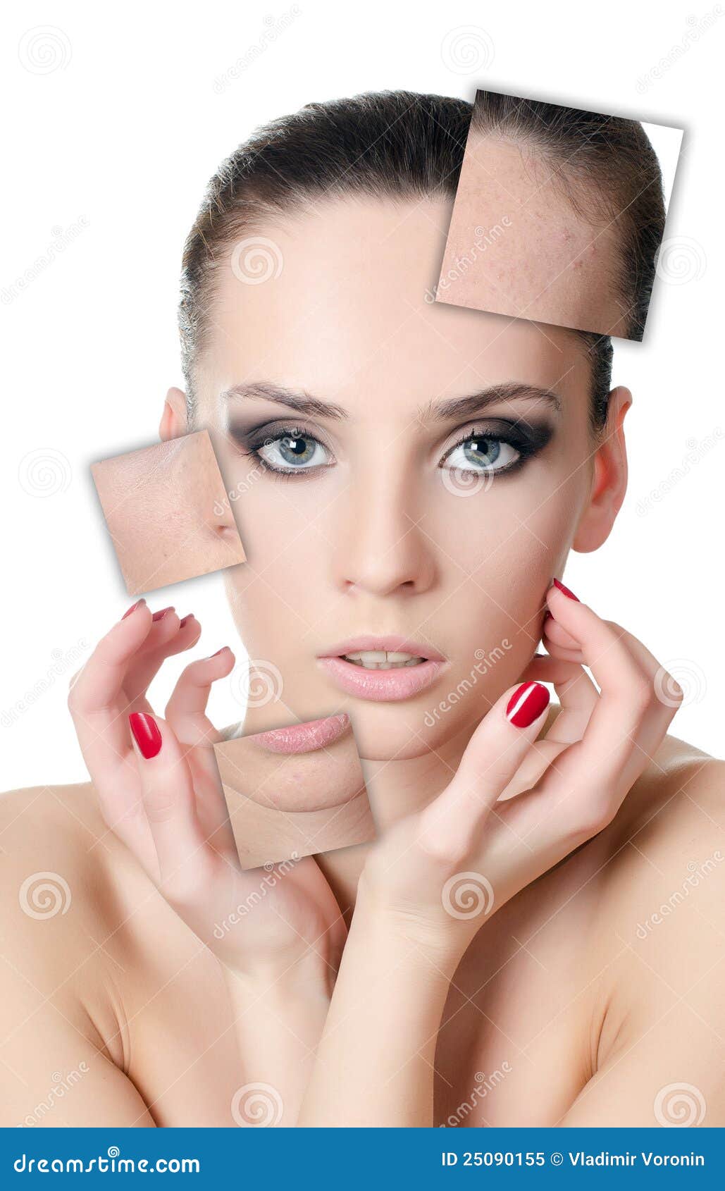 The Beautiful Girl with Problems on the Face Stock Image - Image of ...