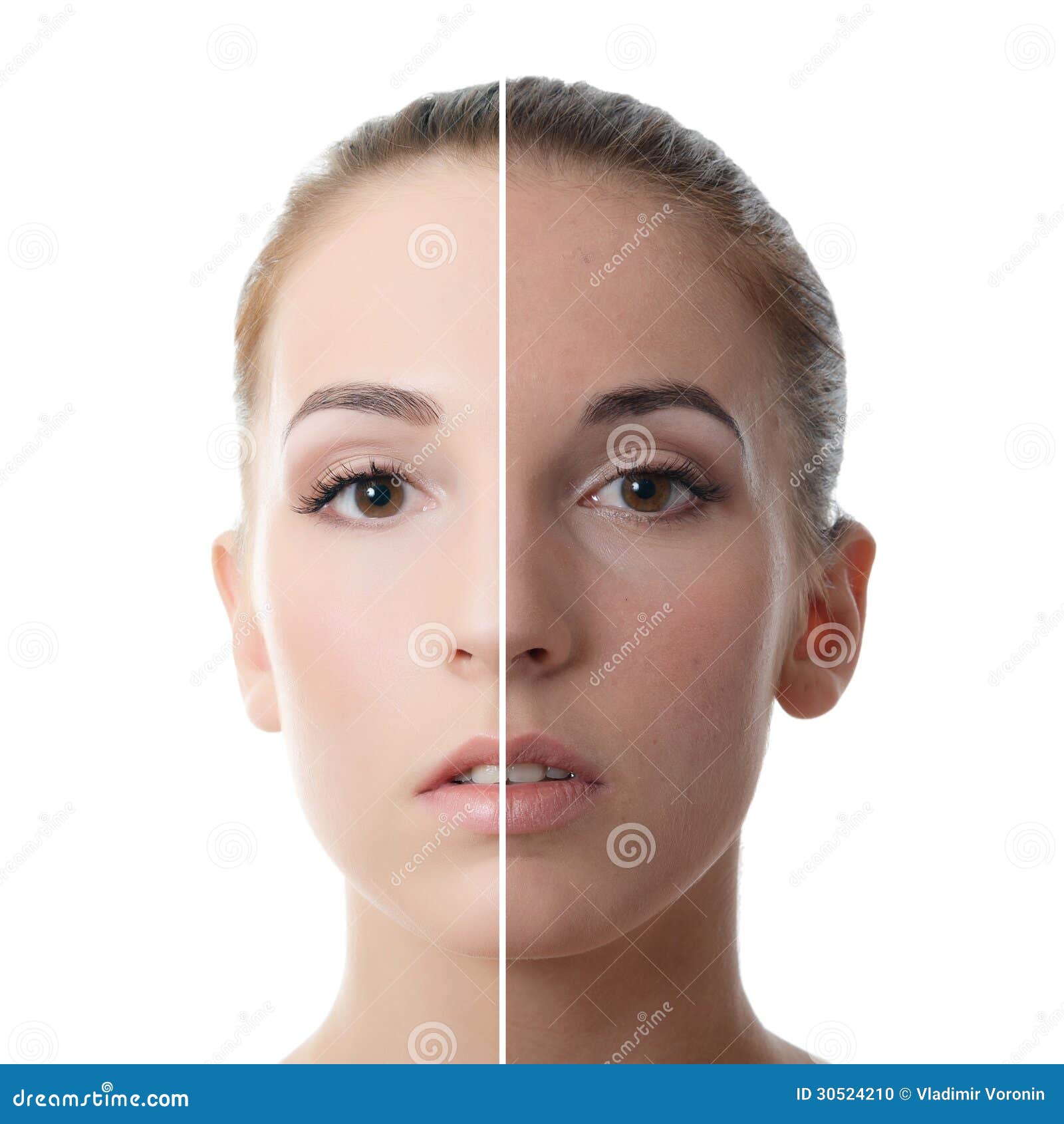 Beautiful Girl with Problems on Face Stock Photo - Image of facial ...