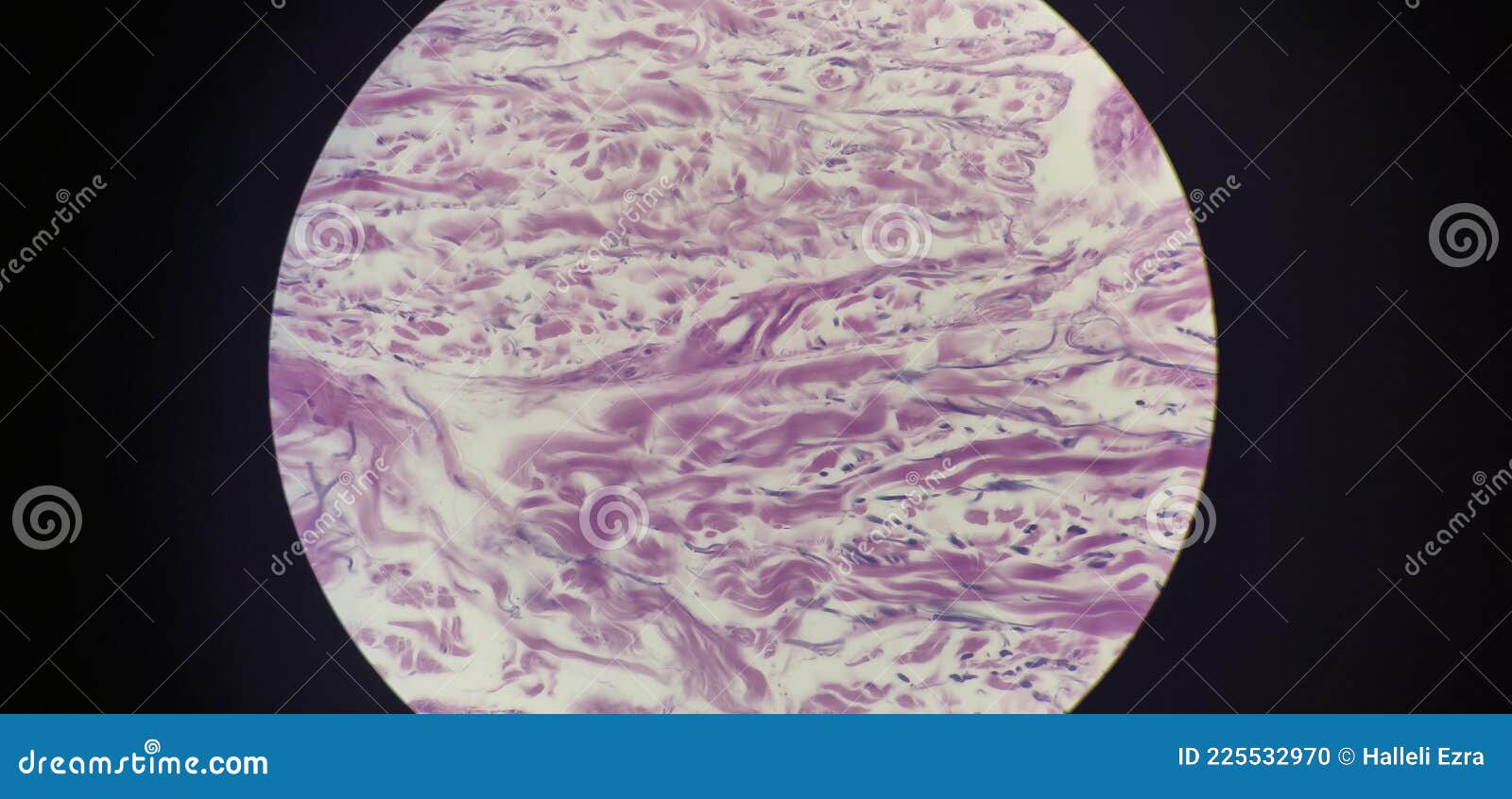 Connective Tissue Under a Microscope Stock Illustration - Illustration ...