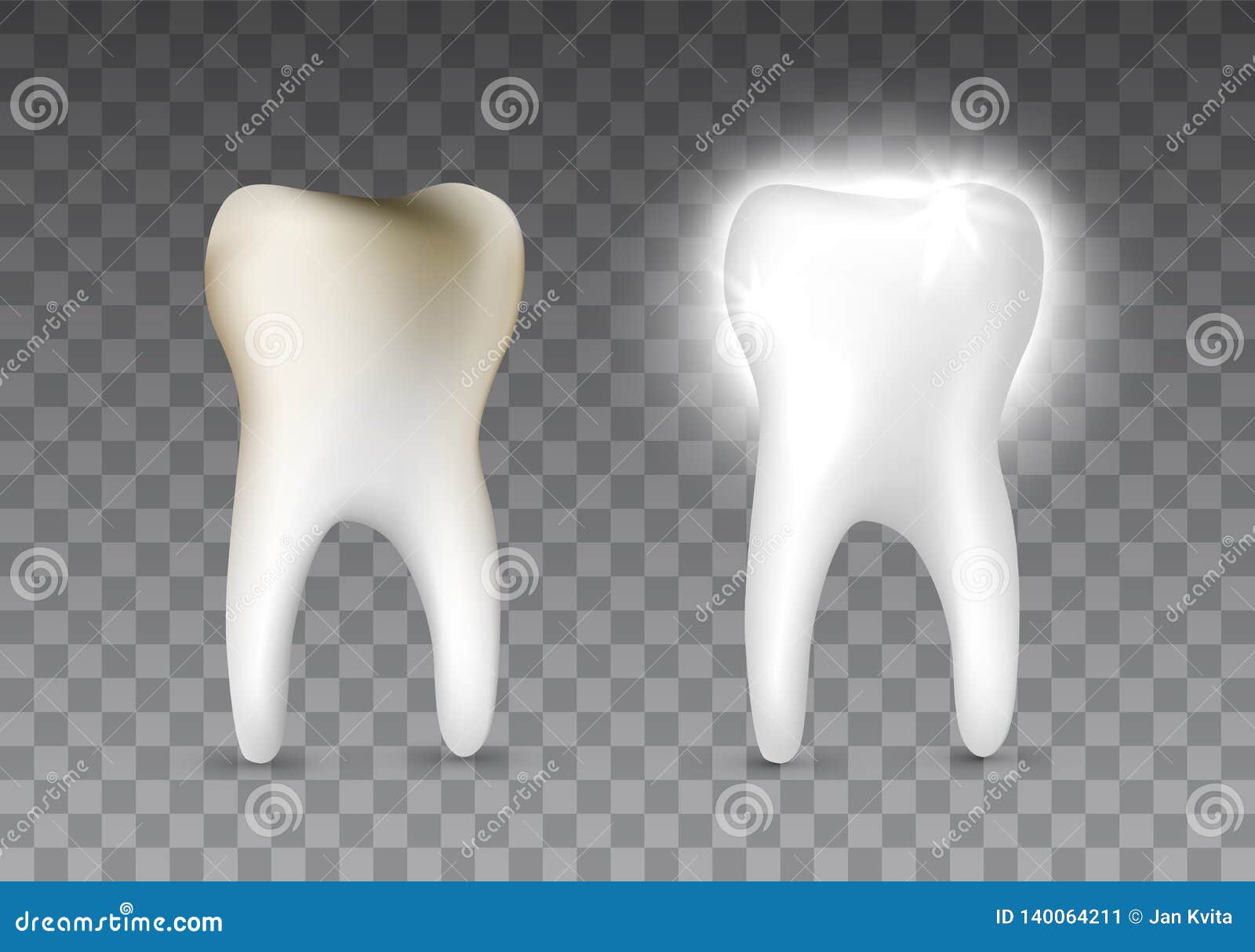 Beautiful Realistic Dentist Vector Set Of Decayed And White Shiny Tooth ...