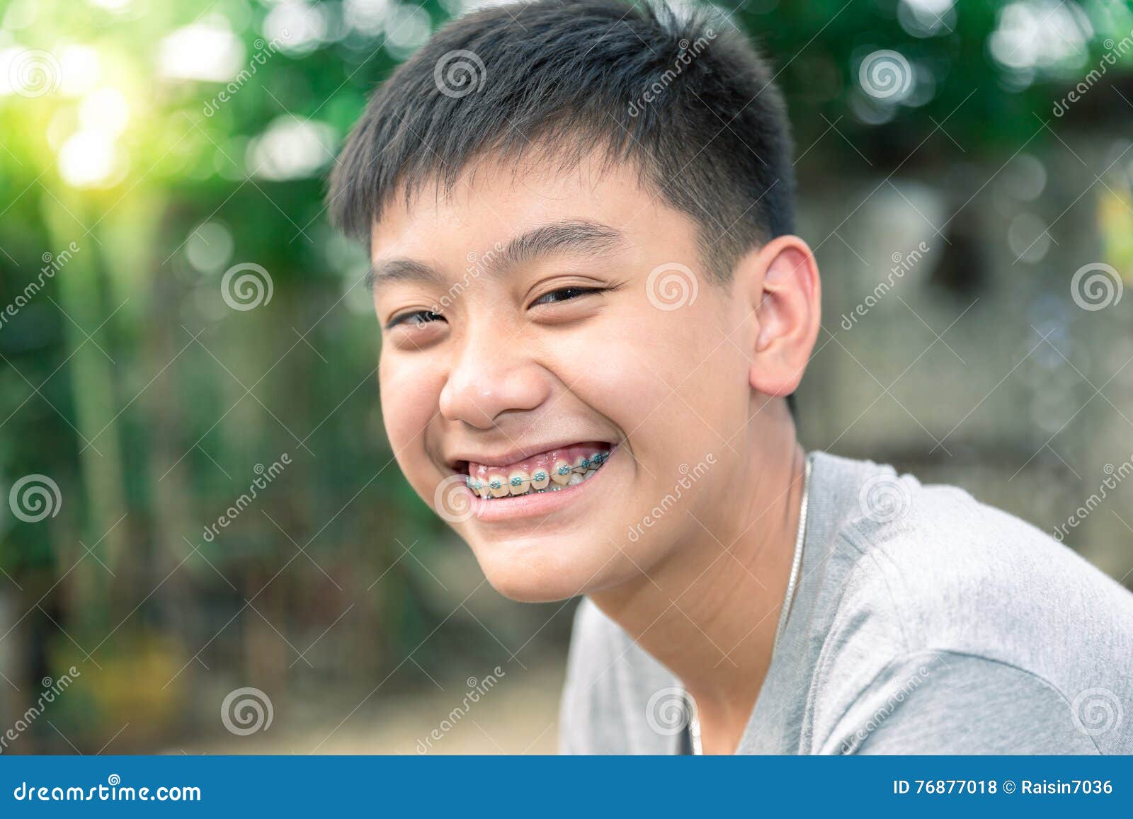 Beautiful Smiling of Handsome Boy with Teeth Brace Dental. Stock Photo ...